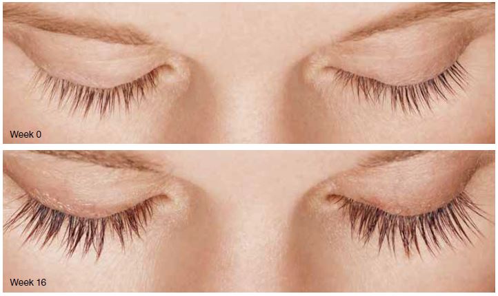 Skinpeccable | Thin Eyelashes | Los Angeles
